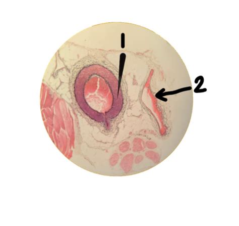 Anatomy And Physiology Lab 9 Heart Flashcards Quizlet