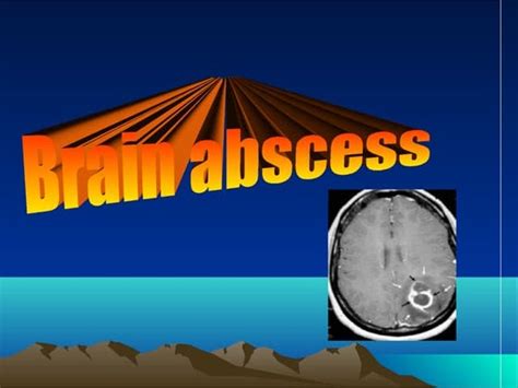 Brain Abscess Ppt