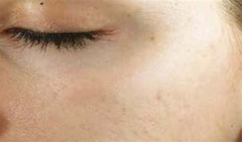 New Image Beauty Bars Procell Therapy New Image Beauty Bar