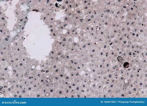 Meiosis In Grasshopper Testis Under The Light Microscope Royalty Free