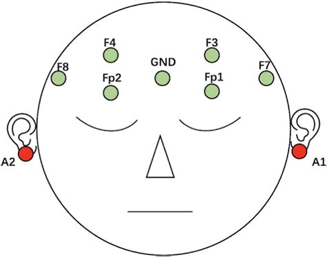 The Electrode Layout Of The Brain Death Eeg Signal Recording Download