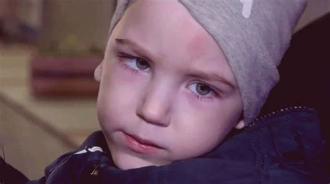 Three Year Old Gavrilo Needs Our Help