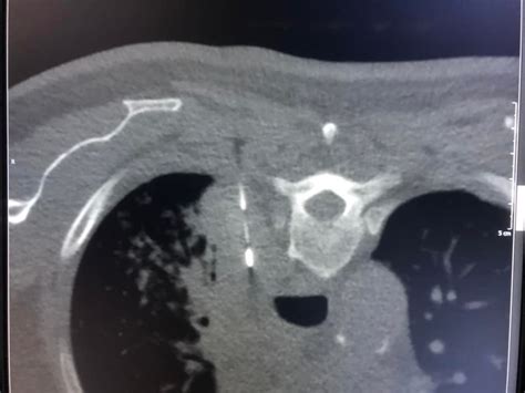 The Filipino Interventional Radiologist