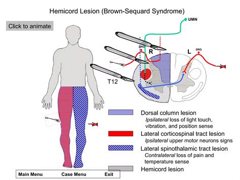 Spinal Cord Lesions Module Pps