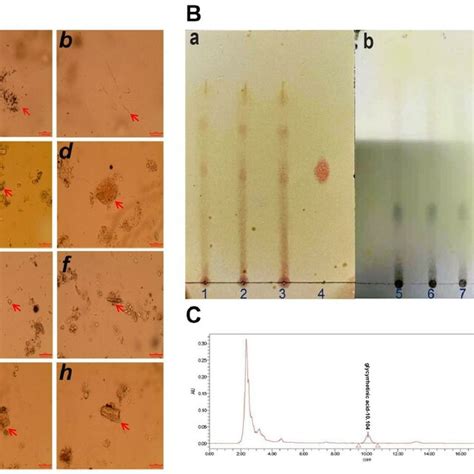 Microscopic Identification The Tlc Identification And Hplc