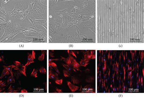 The Cell Morphology Of Tspcs On Different Matrix Surfaces A Cell