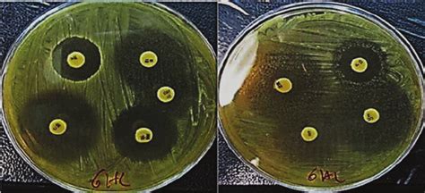 The Susceptibility Spectrum Of Strain 6hl Enterococcus Durans Download Scientific Diagram