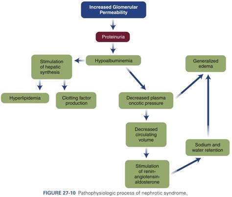 Hospital Student Nephrotic Syndrome