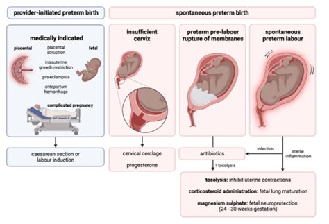 Prom And Pprom Exams Naxlex Nursing