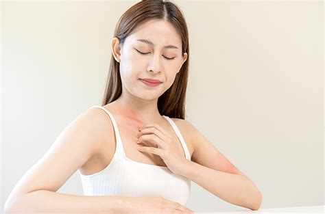 Kenali Ragam Jenis Dermatitis Dan Cara Mengatasinya