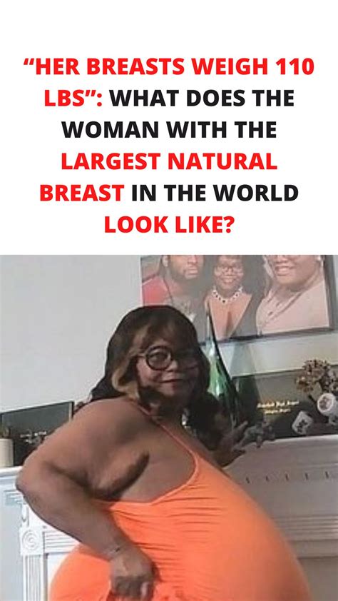 “her Breasts Weigh 110 Lbs” What Does The Woman With The Largest
