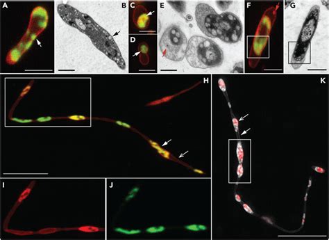 Membrane Phase Separation In Rs P Cells In A C D F And H Download Scientific