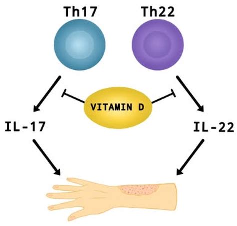 Vitamin D And Atopic Dermatitis—a Mere Correlation Or A Real Supportive