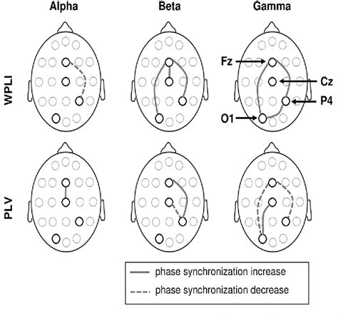 Figure 2 From Analysis And Prediction Of The Freezing Of Gait Using Eeg Brain Dynamics