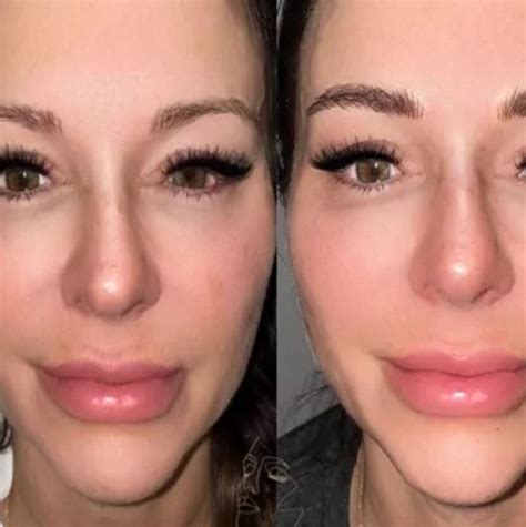 Nano Brows Nano Blading Eyebrows Nano Combo Brows