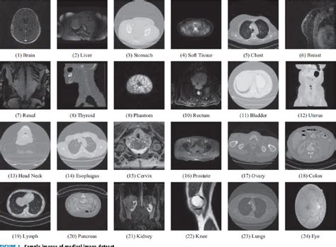 Figure From Deep Convolution Neural Network For Big Data Medical Image Classification