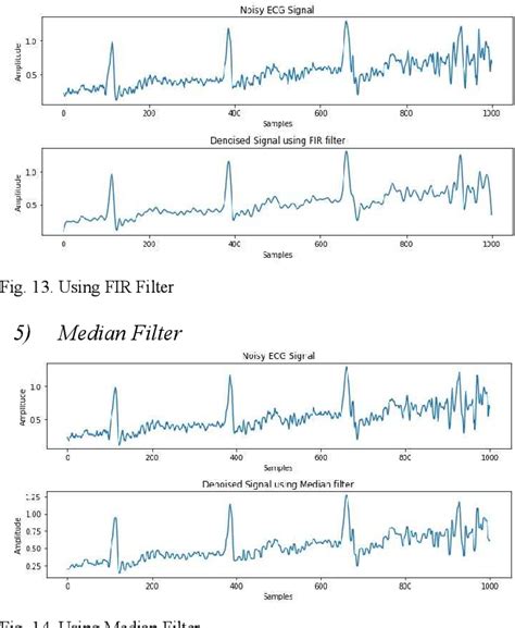 figure 1 from ecg denoising using multiple approaches semantic scholar