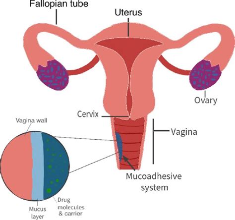 Mucoadhesive Polymeric Systems For Vaginal Drug Delivery A Systemic Review
