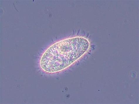 Colpidium Colpoda ~ Everything You Need To Know With Photos Videos