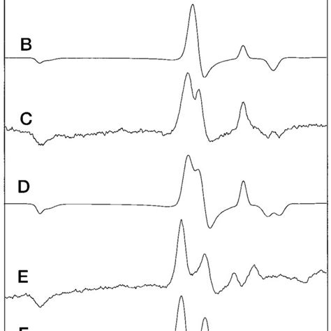 Comparison Of The Difference Spectra From Figs 13 With The