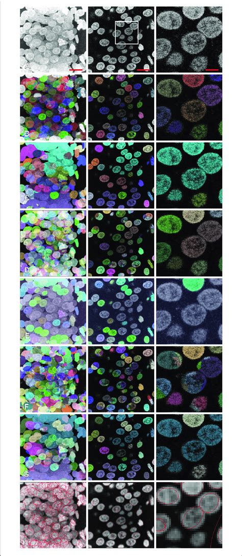 comparison of segmentation results with different other methods a