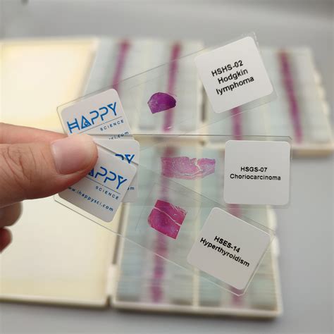 Happy Science Human Pathology Prepared Microscope Slides Individual For