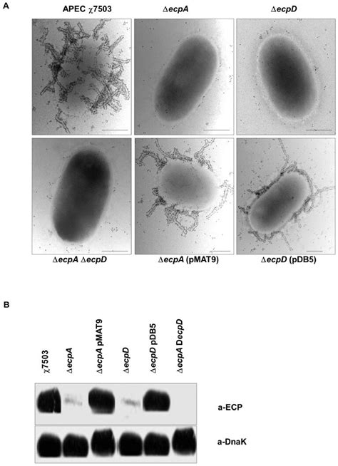 Ecp Expression On The Surface Of Bacteria By Immunoelectron Microscopy Download Scientific