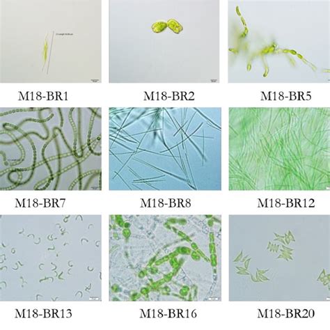 Microscopic Photographs Of Epilithic Microalgae In The Biofilm Of The