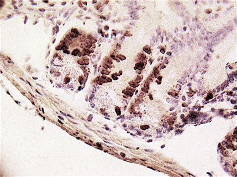 Brdu Cell Proliferation Assay Kits And Antibodies Nordic Mubio