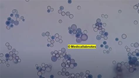 Cryptococcus Introduction Morphology Pathogenicity Lab Diag