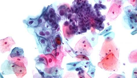 Genital Wart Virus Can Be Passed Through Oral Sex The Center For The Biology Of Chronic