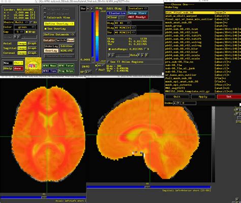 Chapter 7 Checking Preprocessing — Andys Brain Book 10 Documentation
