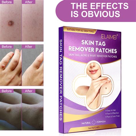 Elaimei Safe Skin Tag Remover Patch Fast Acne Wart Removal Body Face