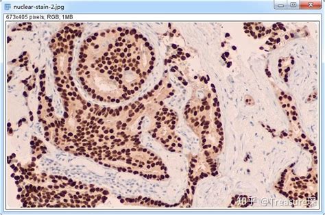 Imagej实用技巧——免疫组化分析定量分析篇 知乎 Imagej实用技巧——免疫组化分析定量分析篇 知乎