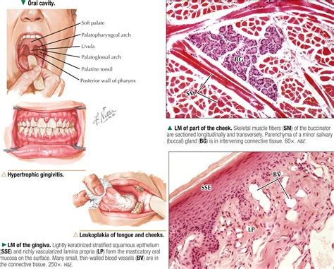 Upper Digestive System Clinical Tree Upper Digestive System Clinical Tree