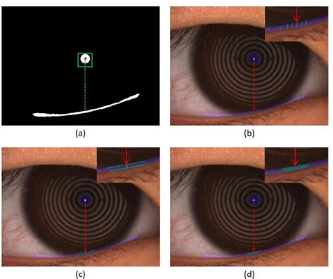 figure 1 from an edge detection based deep learning approach for tear