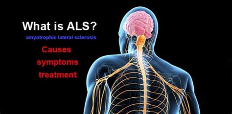 What Is Als Causes Symptoms Treatment And Recommendations