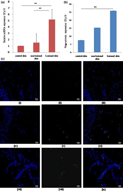 Relative Mrna Expression And Protein Expression Of P16 Senescence Download Scientific Diagram