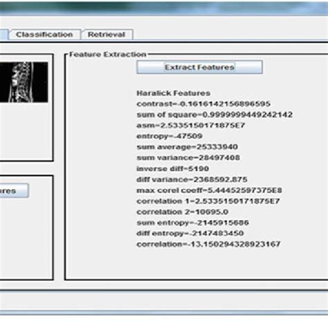 Output Screen For Haralicks Texture Feature Extraction Download