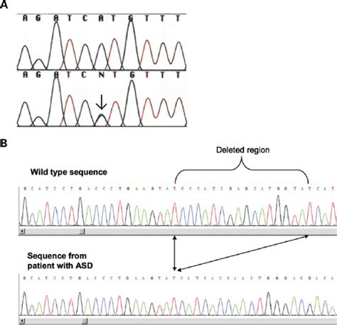 Two Different Cardiac Alpha Actin Mutations Found In Individuals