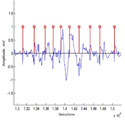 The Registered Electrocardiogram Ecg Signal And Algorithm According Download Scientific
