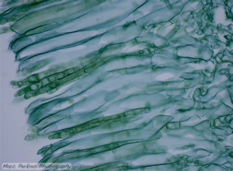 Morchella Under Microscope