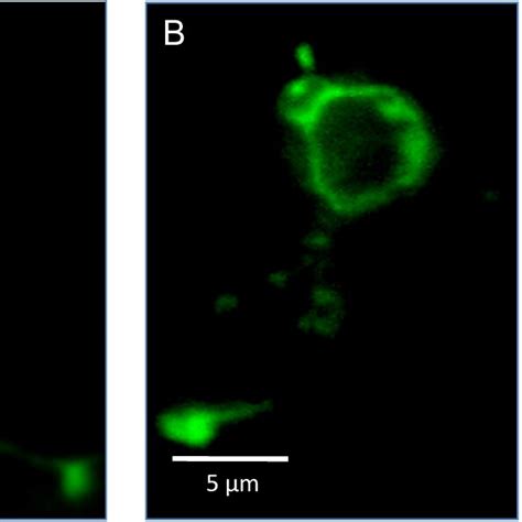 Figure S2 Different Stages Of Photoreceptor Development And Their