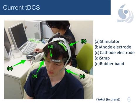 Clinical Application Of Tdcs Pptx