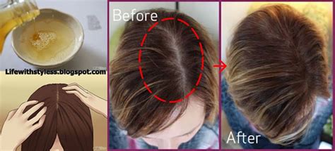 Natural Ways To Regrow Hair In 10 Days Life With Styles