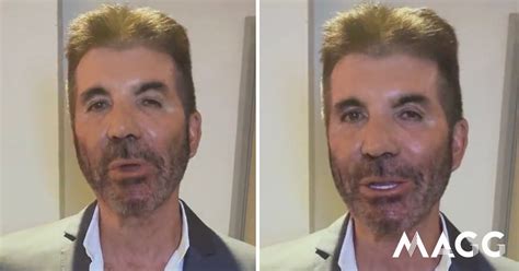 O Que é Que Aconteceu à Cara De Simon Cowell Estrela De Americas Got