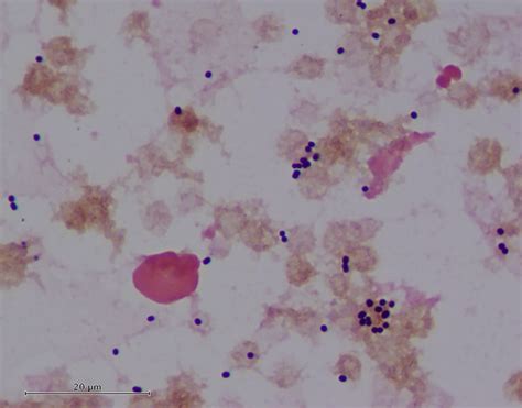 Acinetobacter Gram Stain