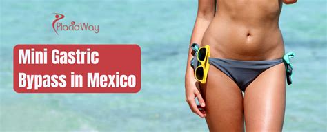 Mini Gastric Bypass In Mexico U2013 Top Clinic And Cost