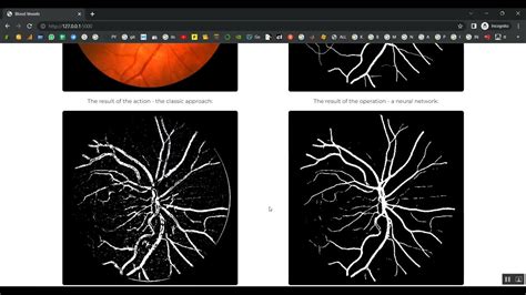 Multi Class Retinal Diseases Detection Using Deep Cnn With Minimal