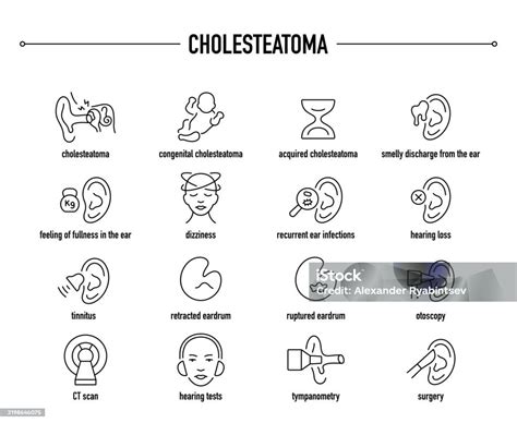 Cholesteatoma Symptoms Diagnostic And Treatment Vector Icon Set Stock